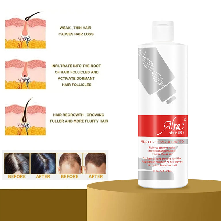 Alra Mild Conditioning Shampoo| Scalp Acne Shampoos | Alra Care – Alra ...