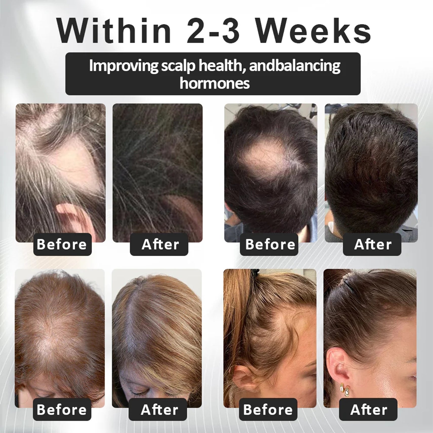 Alra Mild Conditioning Shampoo| Scalp Acne Shampoos | Alra Care – Alra ...