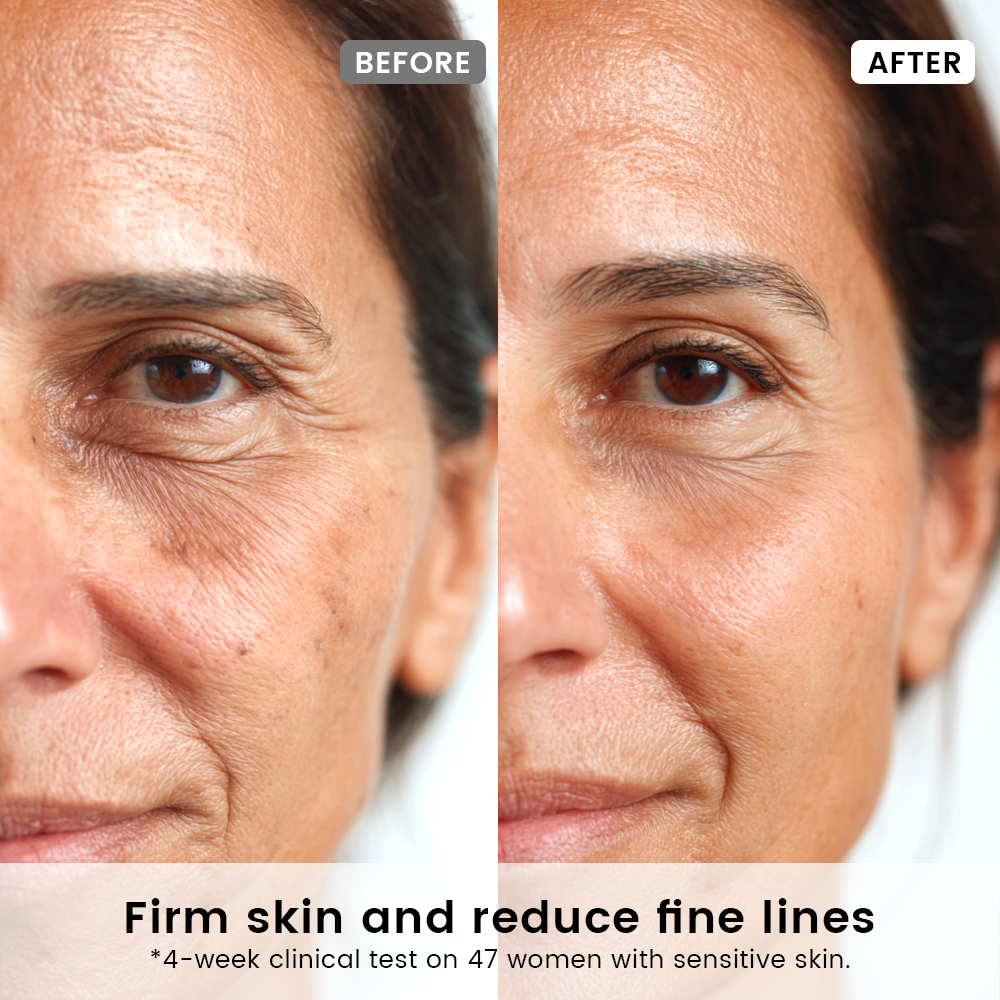 Alra Anti-aging Set – Alra Skin Care