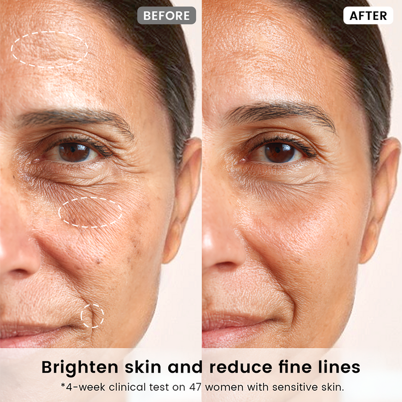 Alra Anti-aging Set – Alra Skin Care