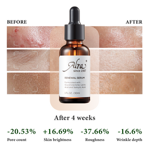 Alra PHA Serum – Alra Skin Care